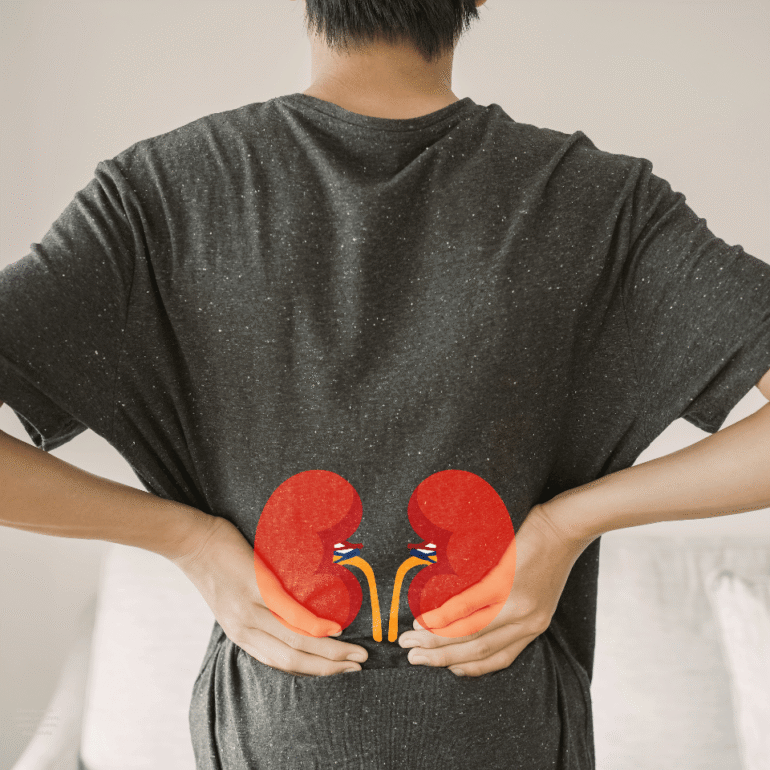 Choroby nerek – rodzaje, przyczyny, objawy, leczenie, diagnostyka | URO ...